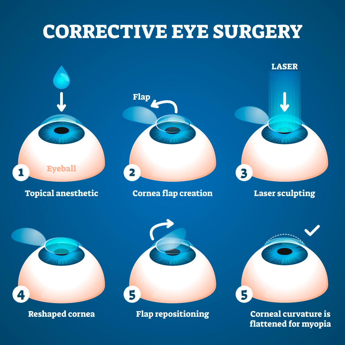 LASIK for Presbyopia in Kansas City, MO | Discover Vision
