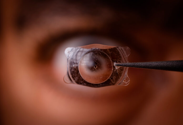 How Much Does Implantable Contact Lens (ICL) Surgery Cost in Kansas ...