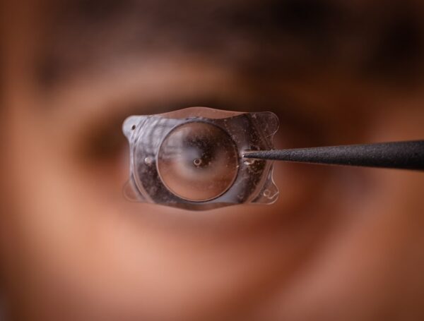 ICL vs. RLE: What Are the Differences? | Discover Vision