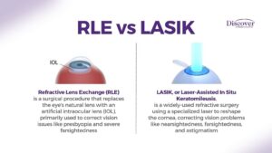 LASIK vs Lens Replacement | Discover Visio