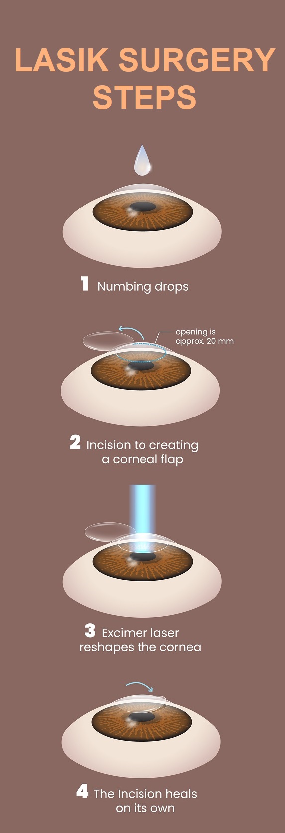 LASIK Kansas City | LASIK Eye Surgery Missouri | Discover Vision