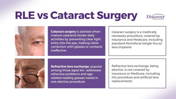 RLE vs Cataract Surgery | Discover Vision