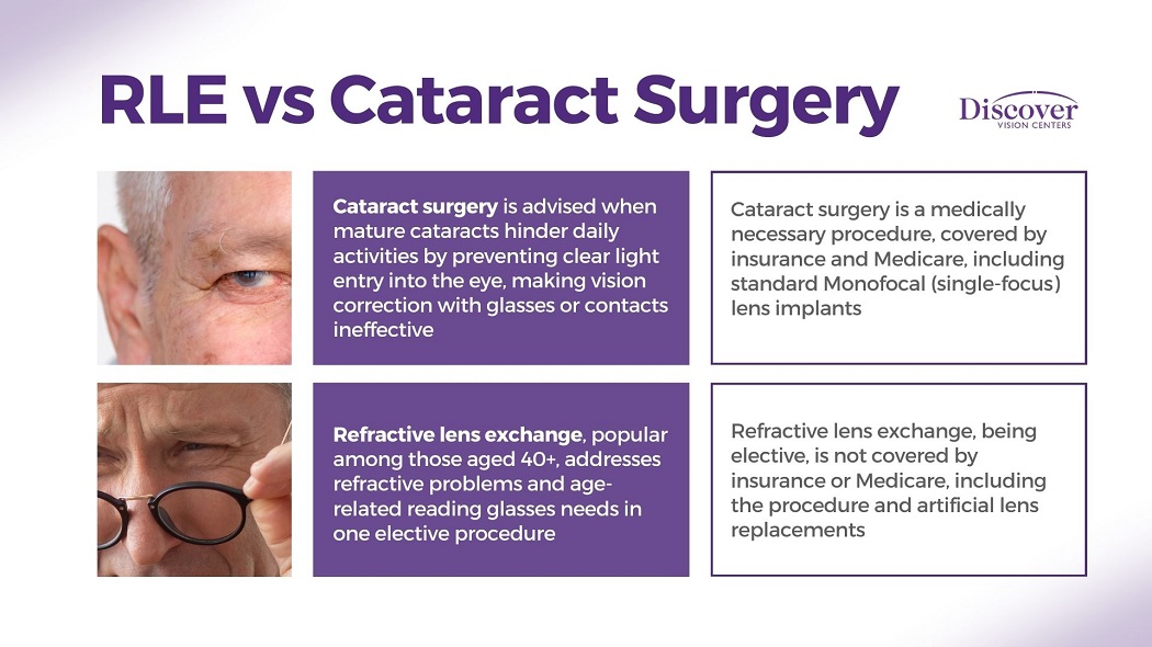 RLE vs Cataract Surgery | Discover Vision