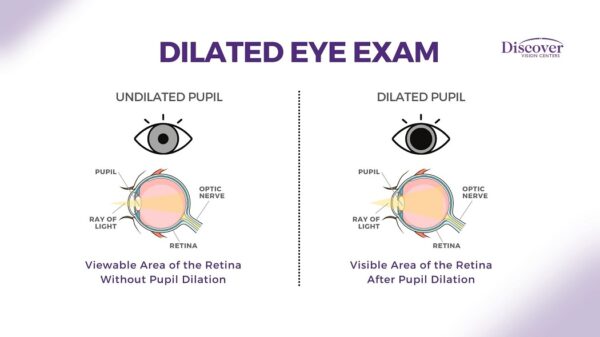9 Types of Eye Tests in Eye Exams | Discover Vision